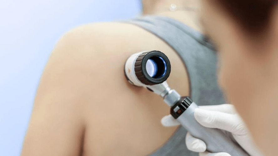Skin Check Frequency: How Often Should You Check for Moles and Cancer? Skin Check Frequency: How Often Should You Check for Moles and Cancer?